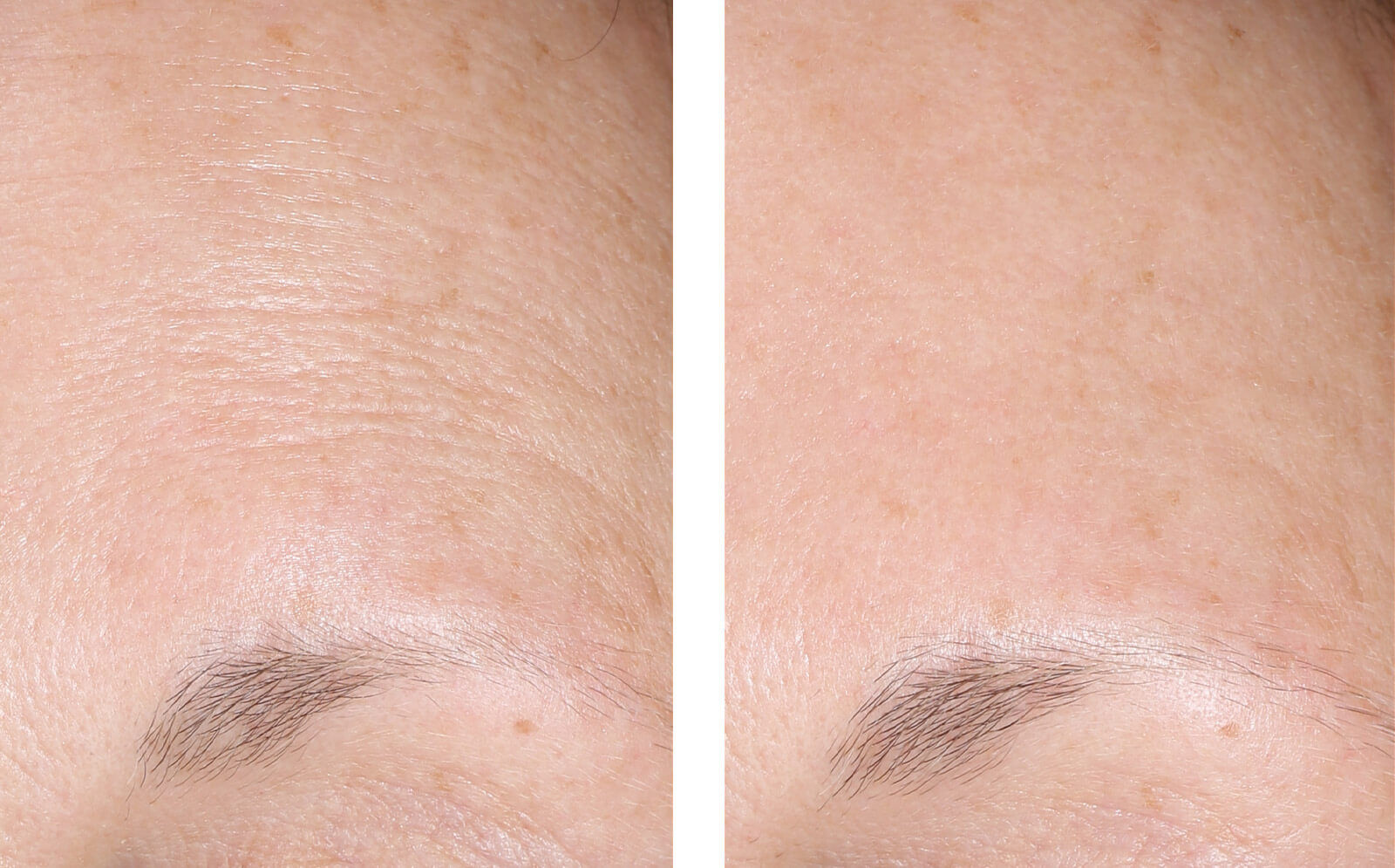 AlphaRet Overnight Cream - Retinoid Cream - SkinBetter Science