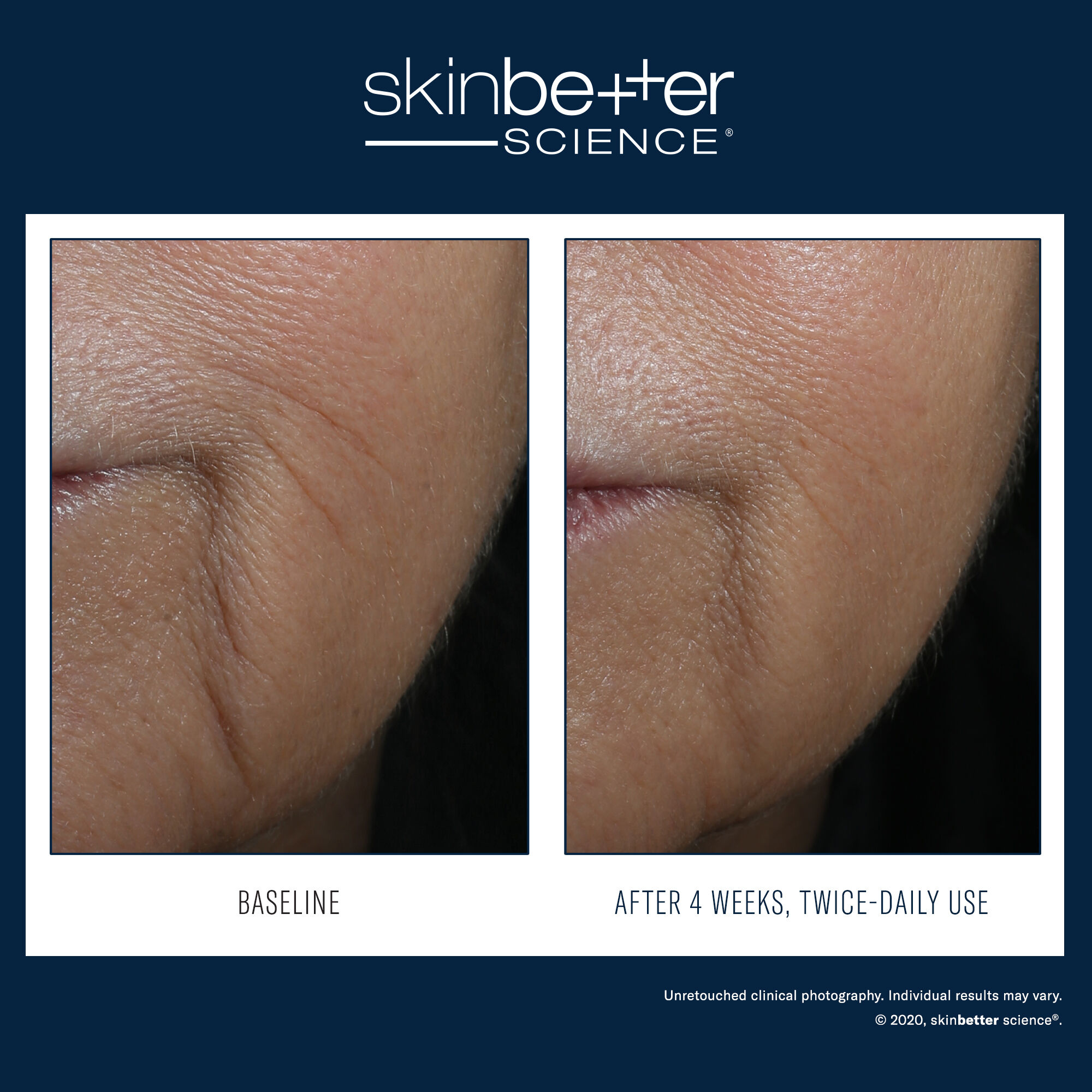 InterFuse - Intensive Treatment LINES - SkinBetter Science