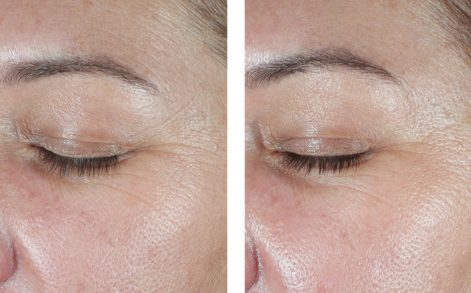 EyeMax AlphaRet Overnight Retinoid Eye Cream - SkinBetter Science