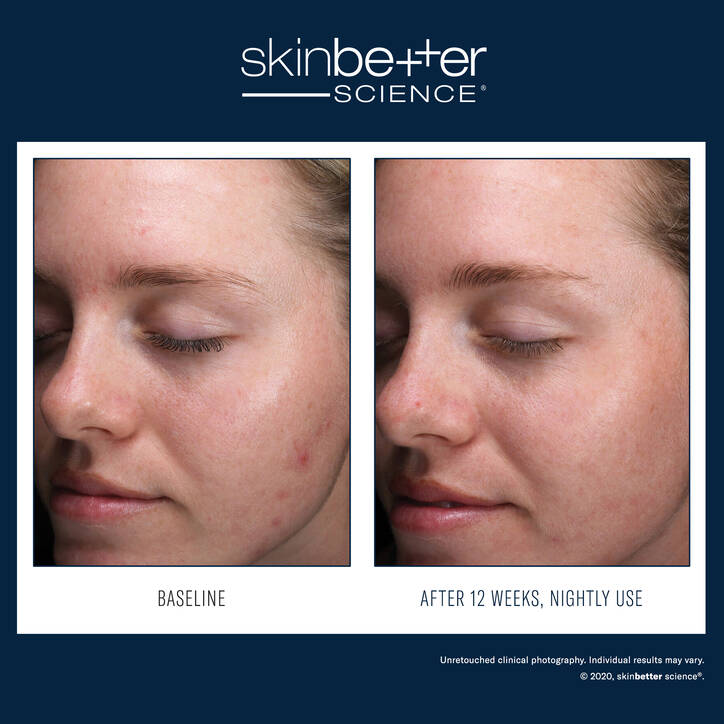 AlphaRet Collection - Retinoid & AHA Skincare - SkinBetter Science