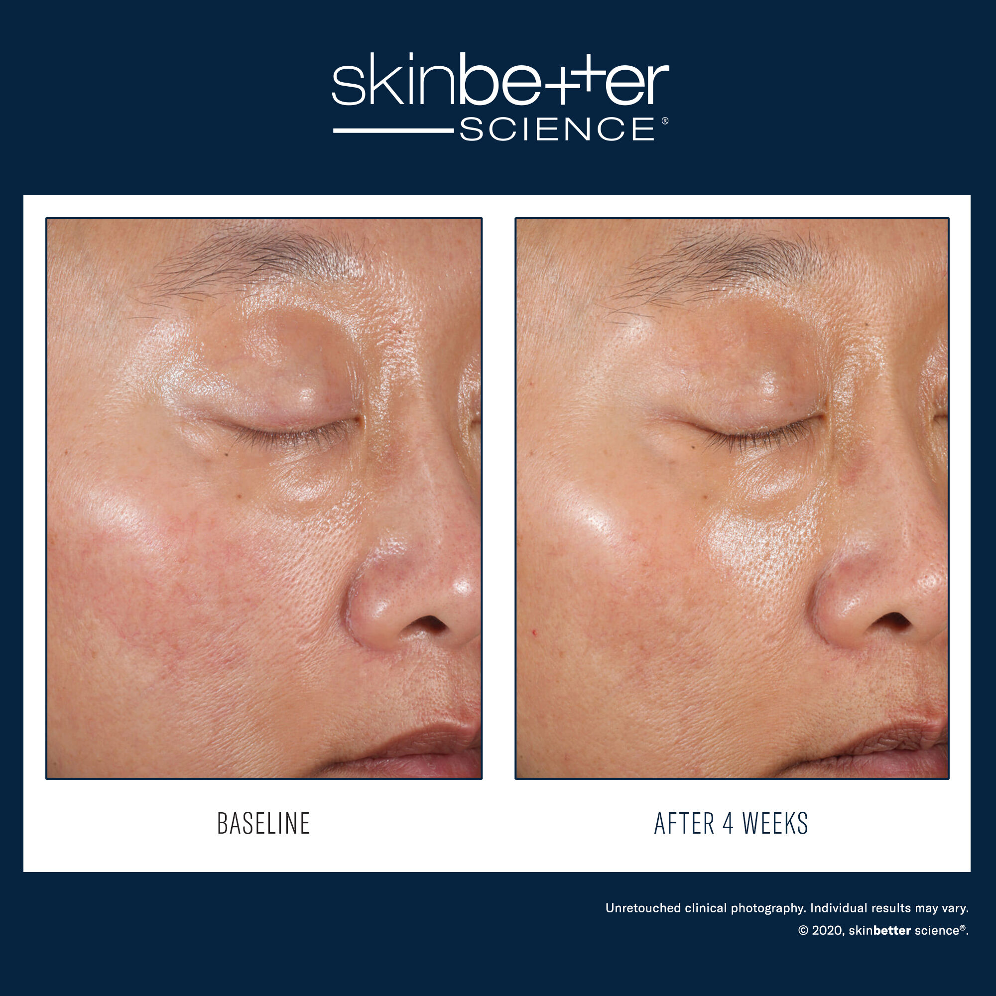 A-Team Duo Kit - Antioxidant & Retinoid - SkinBetter Science