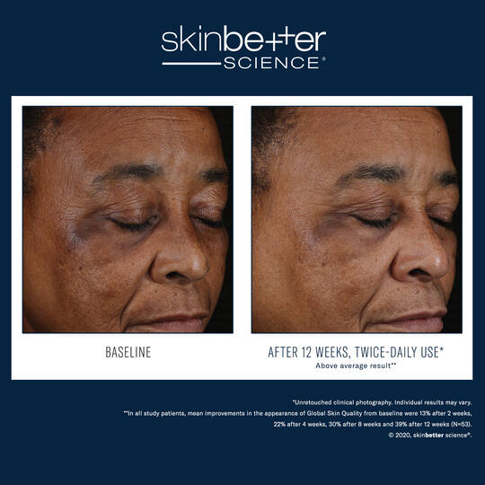 AlphaRet Collection - Retinoid & AHA Skincare - SkinBetter Science